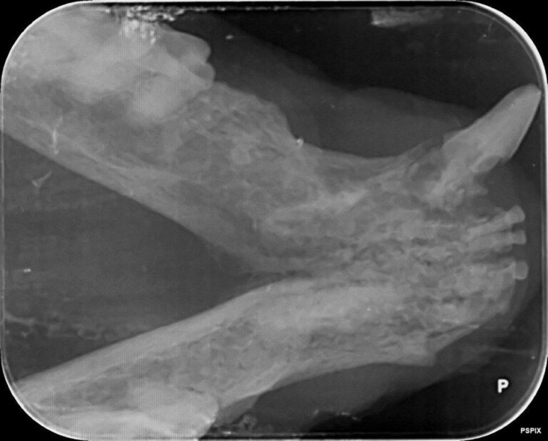 Feline Tooth Resorption: Rosie the Cat's Root Removal Success Story ...